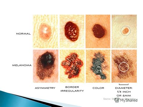 Презентация на тему Разработала учитель биологии экологии МБОУ лицея 90 г Краснодара Брезгина
