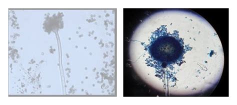 Microscopic Features Of Aspergillus Spp Under Compound Microscope 400x