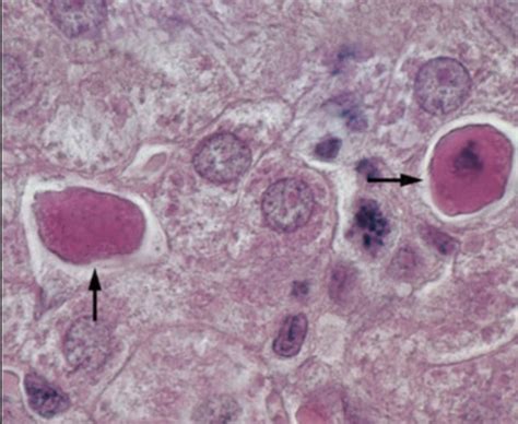 Microbiology Viral Flashcards Quizlet Microbiology Viral Flashcards Quizlet