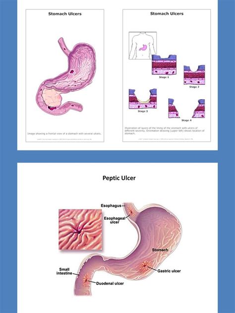 Gastrointestinal Charts And Diagrams With Private Label Rights 46 Gastrointestinal Charts And