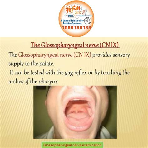 CranialnervesExamination Hashtag On Twitter