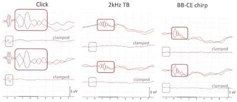 Use Of An Extra Tympanic Membrane Electrode To Record Cochlear