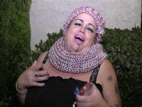 Sonia Operation Repo Before And After