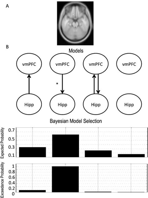 Dynamic Causal Modeling Dynamic Causal Modeling For Phase Coupling Download Scientific Diagram