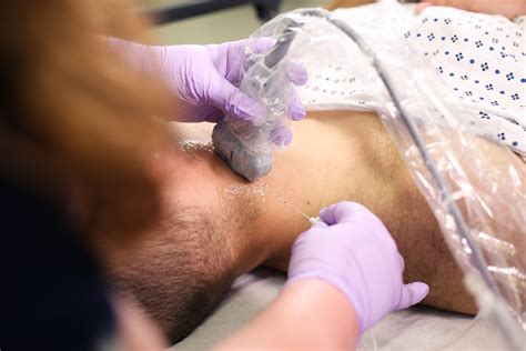 Cervical Plexus Block 7