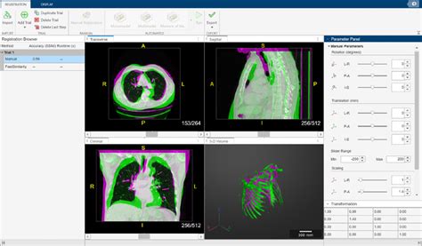 medical image analysis matlab and simulink