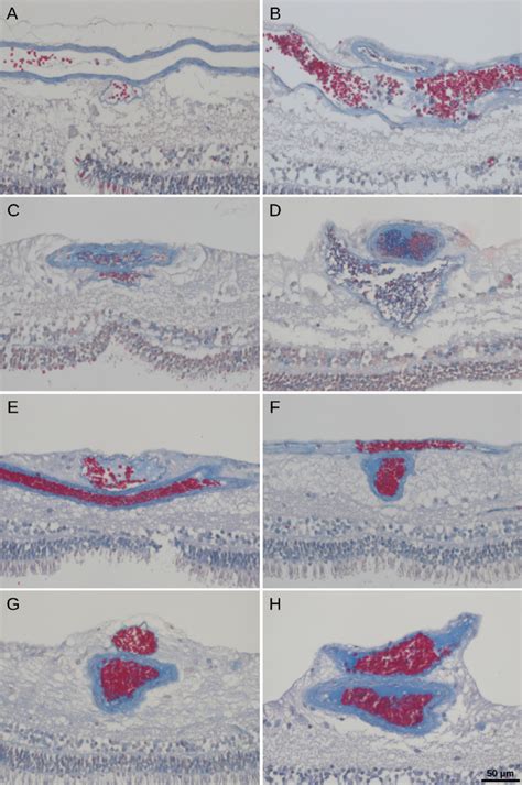 Porcine Retinal Arteriovenous Crossings Images From Serial Paraffin