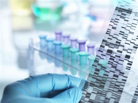 Apakah Gen Dna Dan Kromosom Med Malay