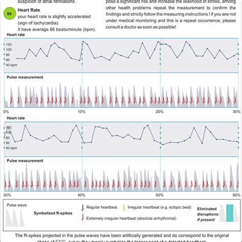 A To F A Zio Patch Monitoring Device B Mydiagnostick C
