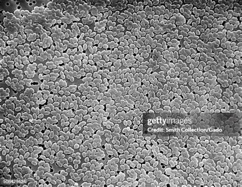 Enterococcus Photos And Premium High Res Pictures Getty Images Enterococcus Photos And Premium High Res Pictures Getty Images