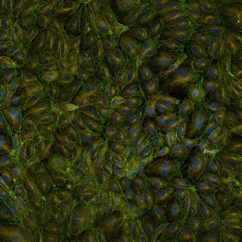 Huvec Cultured Under Flow F Actin Green β Tubulin Orange Nuclei Blue Galleries