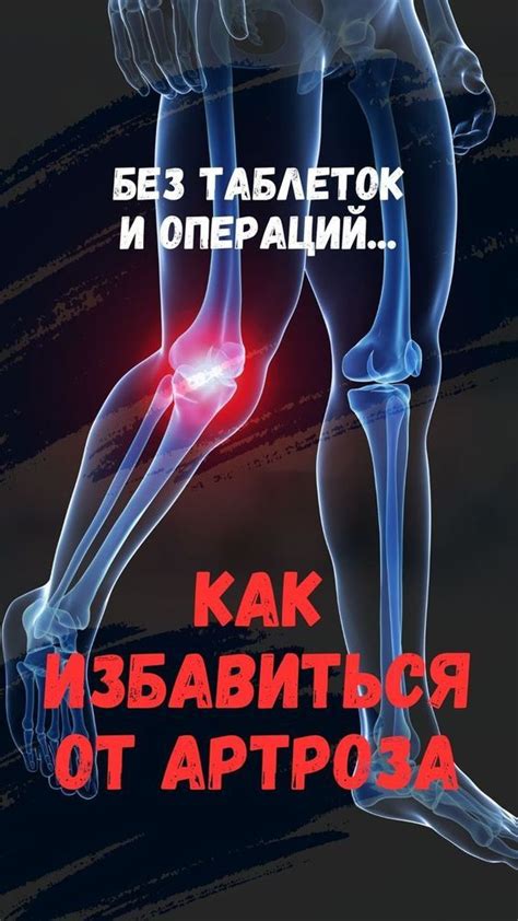 медиол повреждение артроз симптомы артроз суставов колен разрушение коленных суставов причины