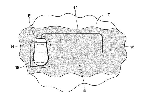 Central Nervous System Patented Technology Retrieval Search Results Eureka Patsnap