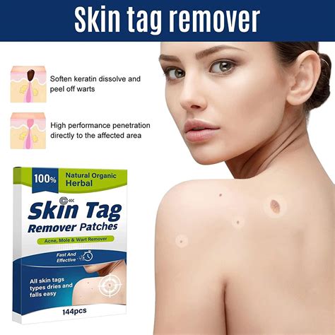 Skin Tag Remover Patch 144 Pcs Safe And Effective Skin Tag Removal