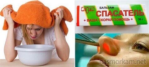 Корки в носу - причины возникновения, народные способы лечения