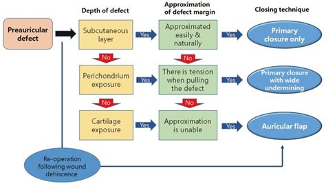Reconstruction Algorithm Of Post Preauricular Sinus Excision Download Scientific Diagram