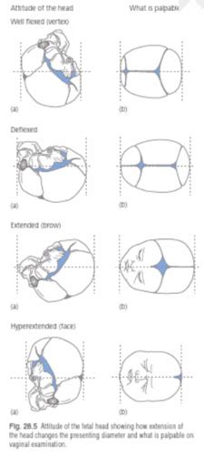 Labour Mechanisms Anatomy And Physiology Flashcards Quizlet