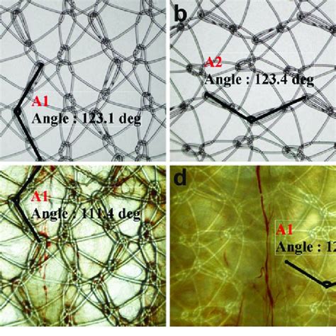 Operative Technique Of The ‘‘components Separation Technique 1