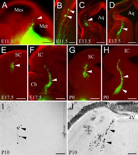 Figure 2 From Development Of The Mesencephalic Trigeminal Nucleus Requires A Paired Homeodomain