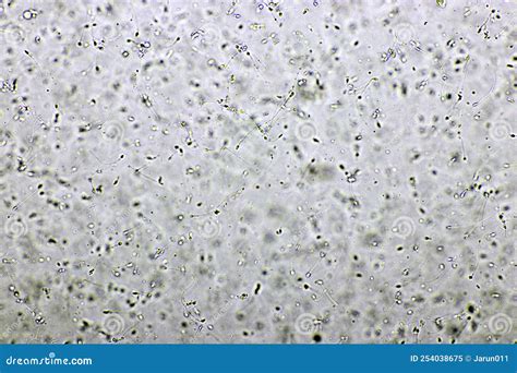 Sperm Cell Under Microscope