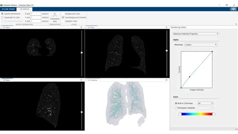 Three Dimensional Reconstruction For The Whole Lung With Early Multiple