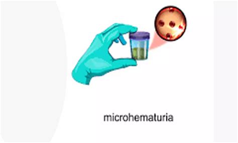 Management Of Microhematuria Auasufu Guidelines