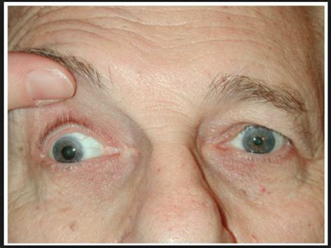 Ocular Anatomy And Physiology Cranial Nerves Innervation Of Ocular Structures Part 2