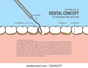 3 904 Dental Scaling Images Stock Photos Vectors Shutterstock