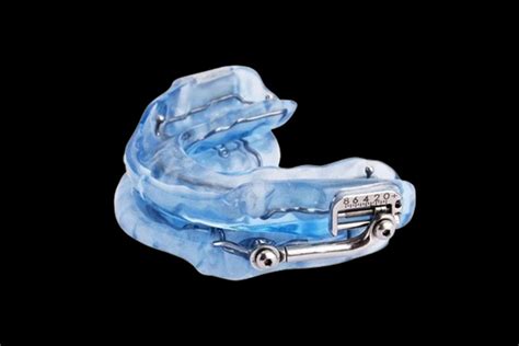 Herbst Oral Appliance Dental Lab From China Bestodental