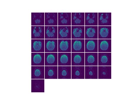 Mosaic Plot Pycortex 1 2 11 Documentation