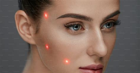 뷰티 트리트먼트 부드러운 피부와 얼굴에 빨간 레이저 포인트를 가진 아름다운 젊은 여성의 초상화 회색 배경에 성형 수술 전에