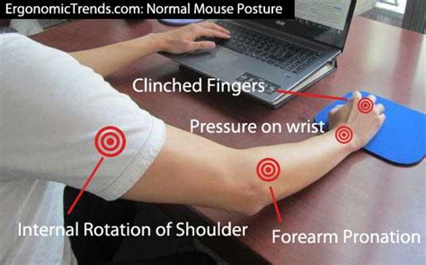 Vertical Mouse Benefits And How To Use Them Properly Ergonomic Trends