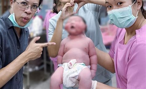 ไวรัล ซูโม่ตัวน้อย แห่งชายแดนไทย เมียนมา น้ำหนักแรกเกิดทะลุ 5 โลฯ