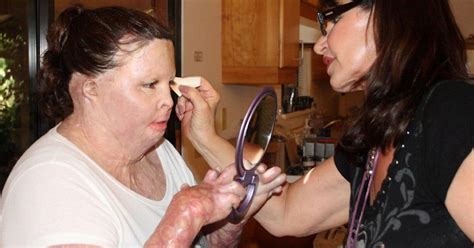 Angel Faces Retreat A Healing Journey For Burned Teen Girls