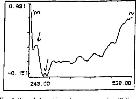 Figure 4 From Feature Extraction From Ventricular Late Potentials With Clinical Validations