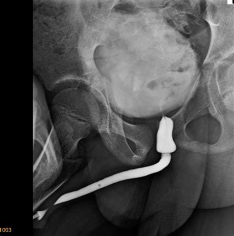 Case Radiology Wikiradiology Teleradiology Freeservices Urology