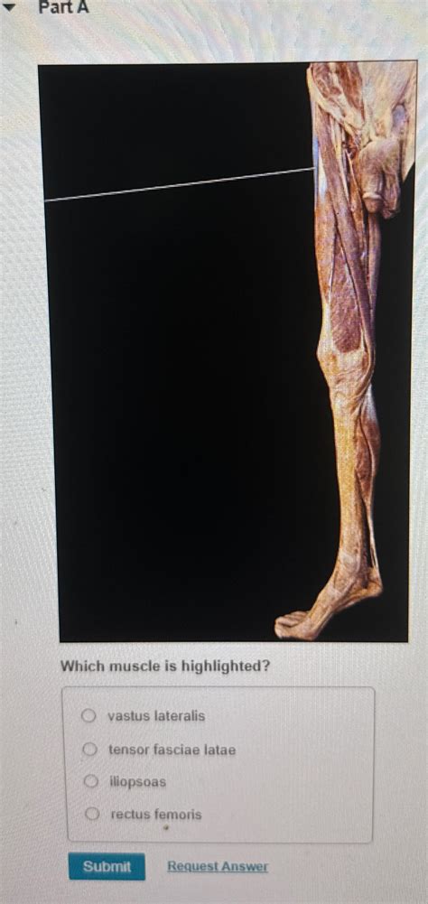 Solved Part Awhich Muscle Is Highlightedvastus