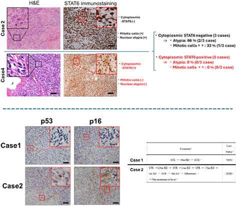The Significance Of Cytoplasmic Stat6 Positivity And High P53p16