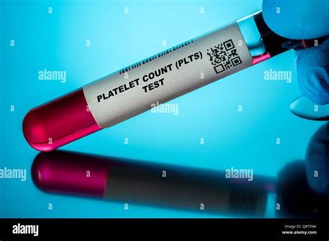 Platelet Count Plts Test Blood Tests For Older Adults Recomm Hi Res