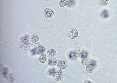 Microscopic Examination Of Urine Flashcards