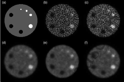 Images Reconstructed From The Esser Phantom By Various Oe Algorithms