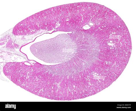 Renal Pyramid Histology