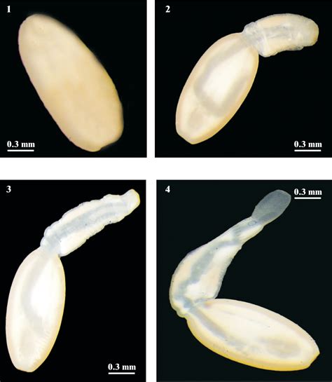 Figure 1 4 From On The Larval Stages Of Polymorphus Spindlatus