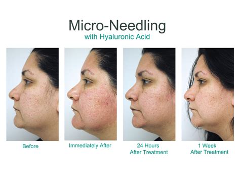 Pin On Before And After Photos