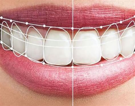 Dr Juan Carlos Restrepo Talero Odontologo Las Páginas Amarillas En