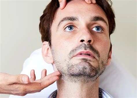 Gaunt Face And How To Get Rid Of It Time Clinic