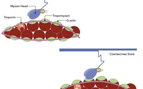 High Sensitivity Cardiac Troponin On Presentation To Rule Out Myocardial Infarction A Stepped