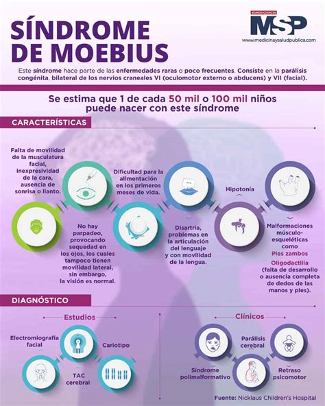 Síndrome De Moebius Infografía