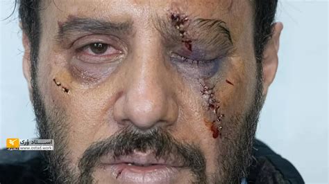 وضعیت جواد عزتی، بازیگر سینمای ایران بعد از درگیری استادورک