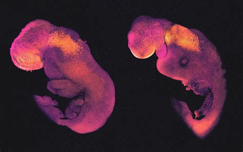 Elephant Embryo Vs Human Embryo